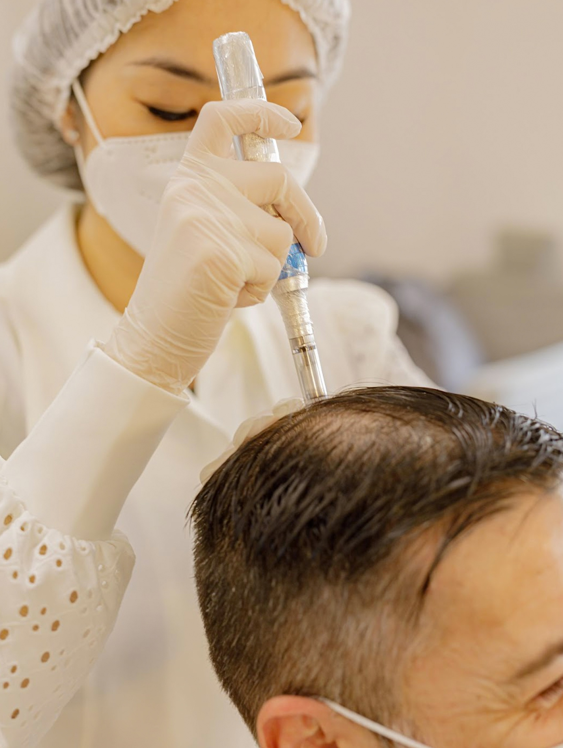 Terapia capilar para homens: 3 tratamentos que fazem sucesso entre eles ...